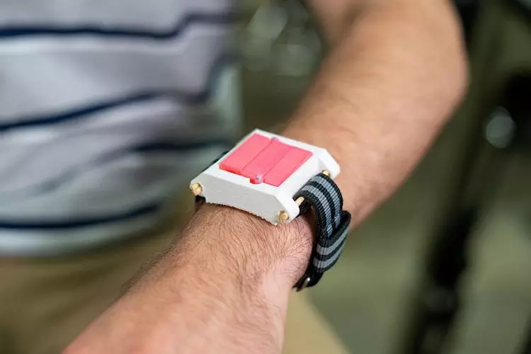 Vergeet smartwatches! Hier is EpiWear-spuithorloge om allergische mensen snel te helpen